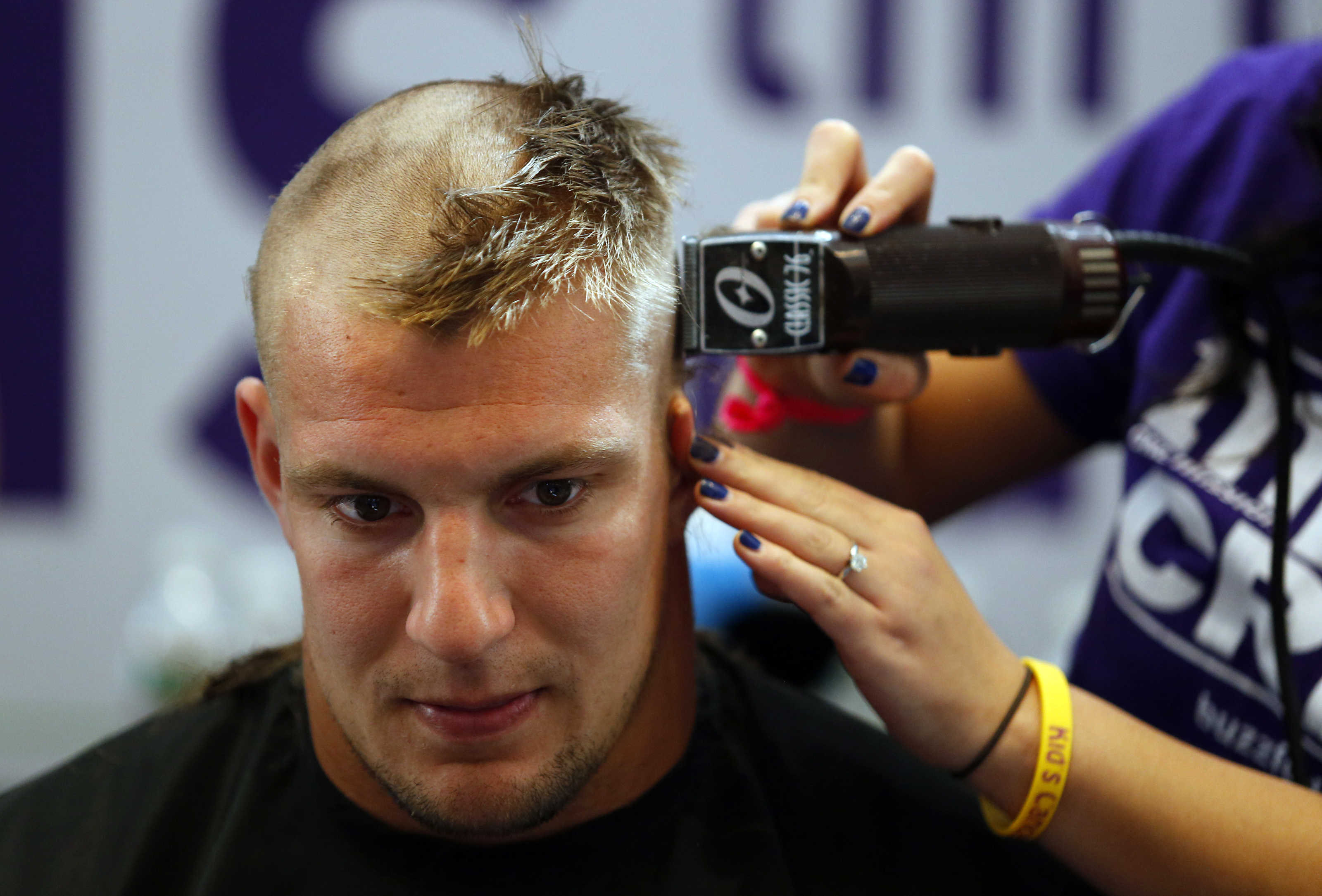 Rob Gronkowski gets a buzz cut for One Mission - The Boston Globe